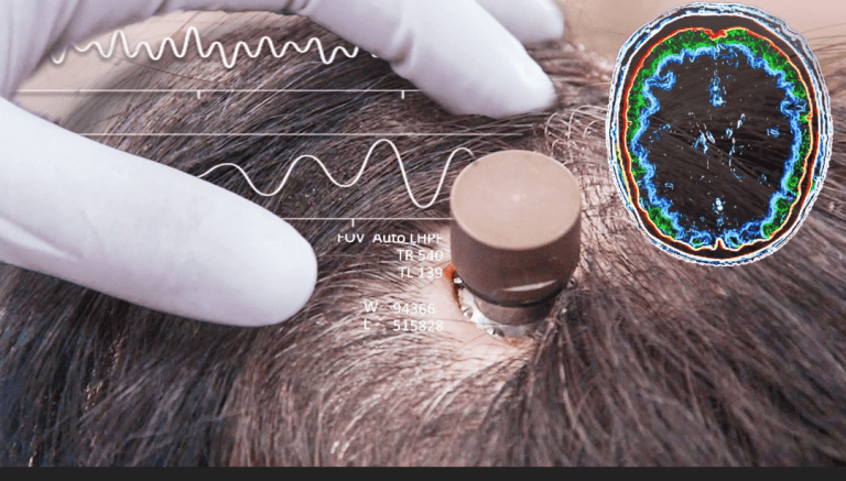BCI, China Has Implanted 3 Humans with Brain Chips : Breakthrough in ...